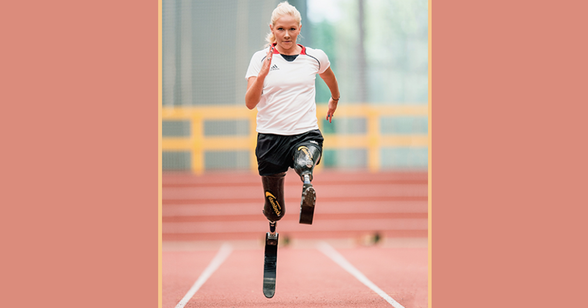 Vanessa Low: „Meine Prothesen bedeuten Lebensqualität"