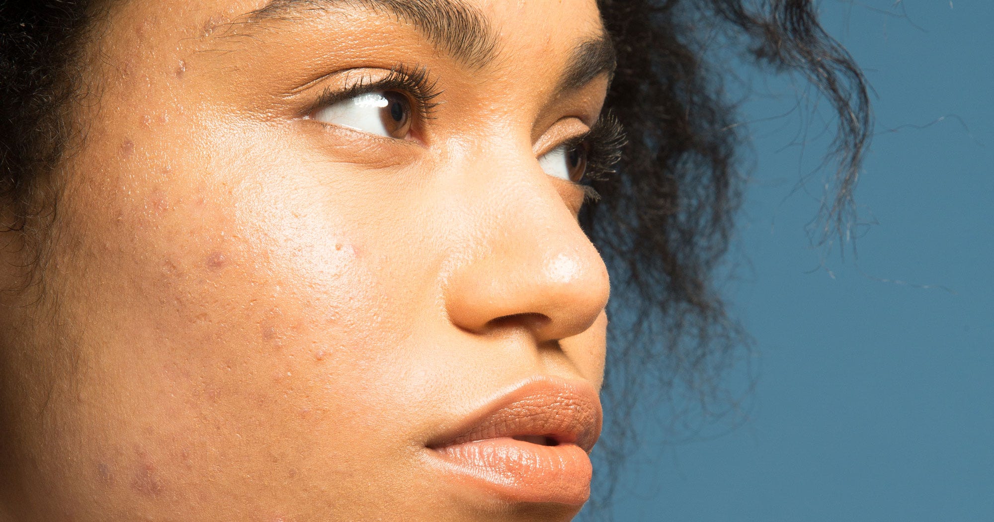 Black Skin Care Dermatologist Red Flags Need To Know