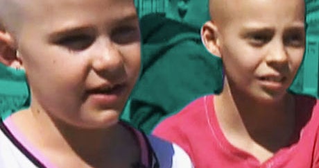 Shaved Head - Cancer Support, Dress Codes