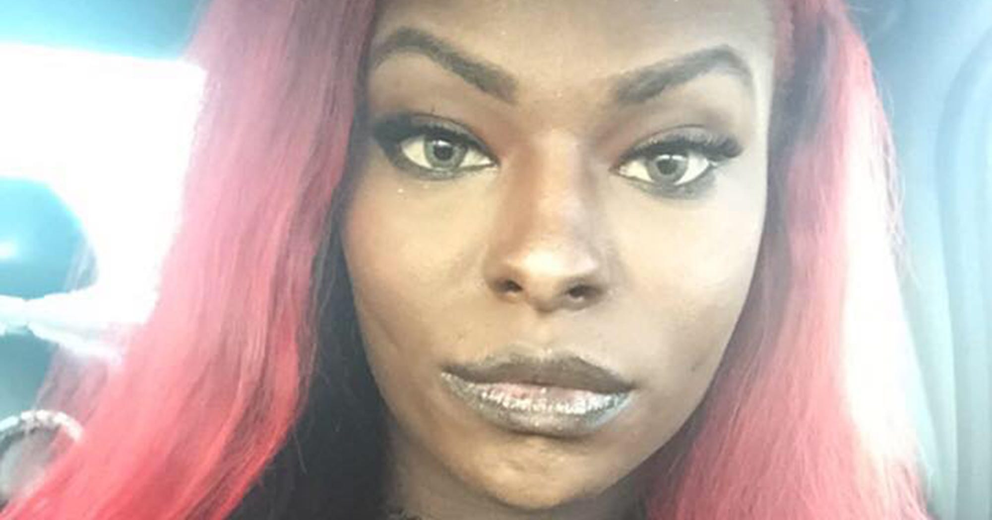 Trans Woman Shot Five Times Is Misgendered In Press