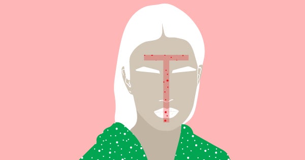 Oily T-Zone Treatments For Greasy Skin