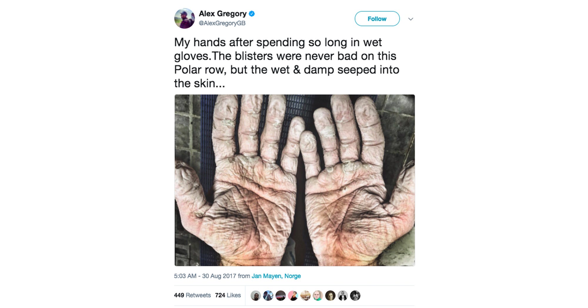 Alex Gregory Olympic Rower Hands Photo Viral