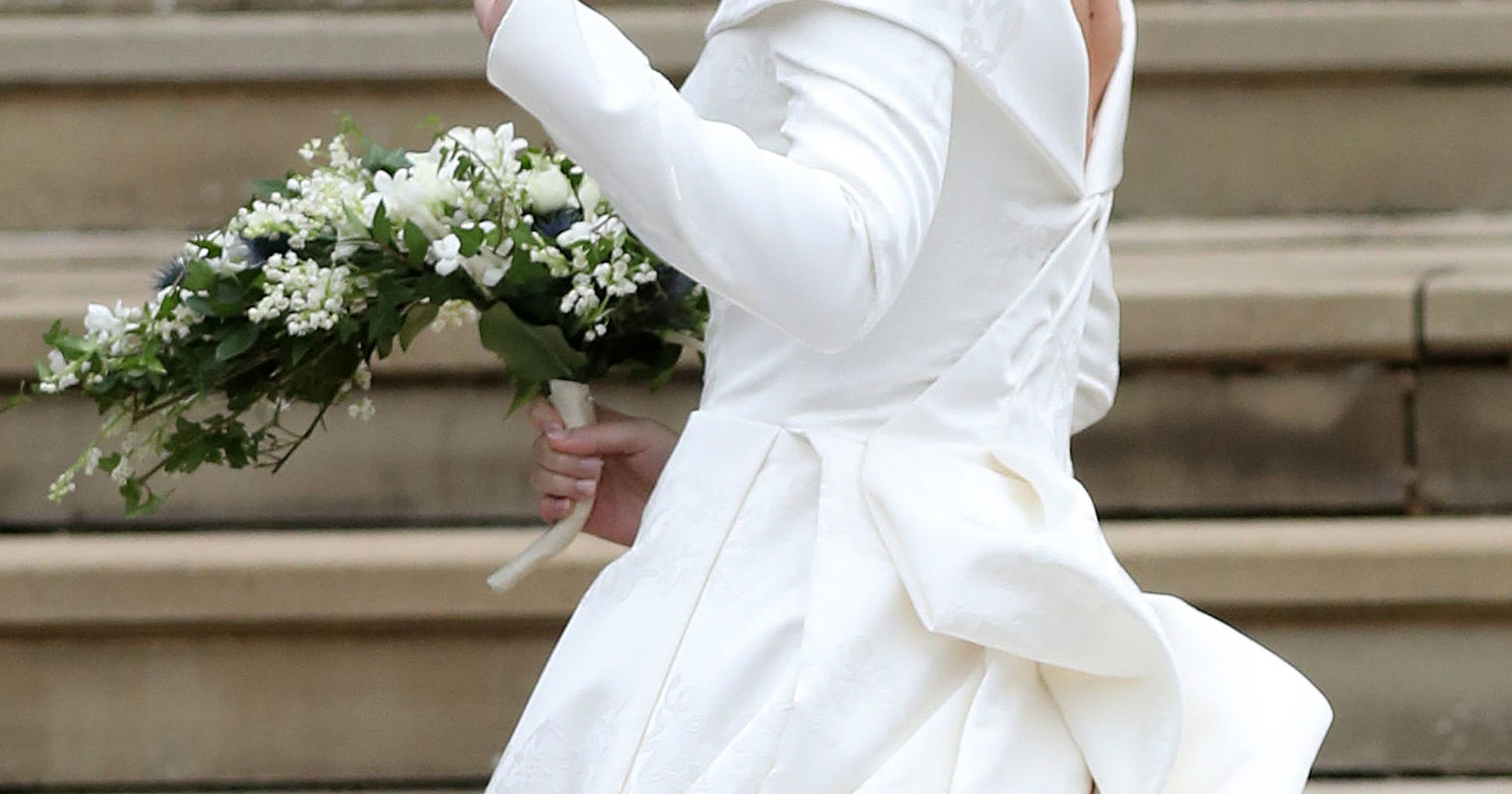 How Princess Eugenie Surgery Scars Are Inspiring Women