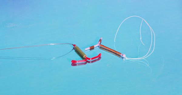 What IUD Contraceptive Coil Feels Like